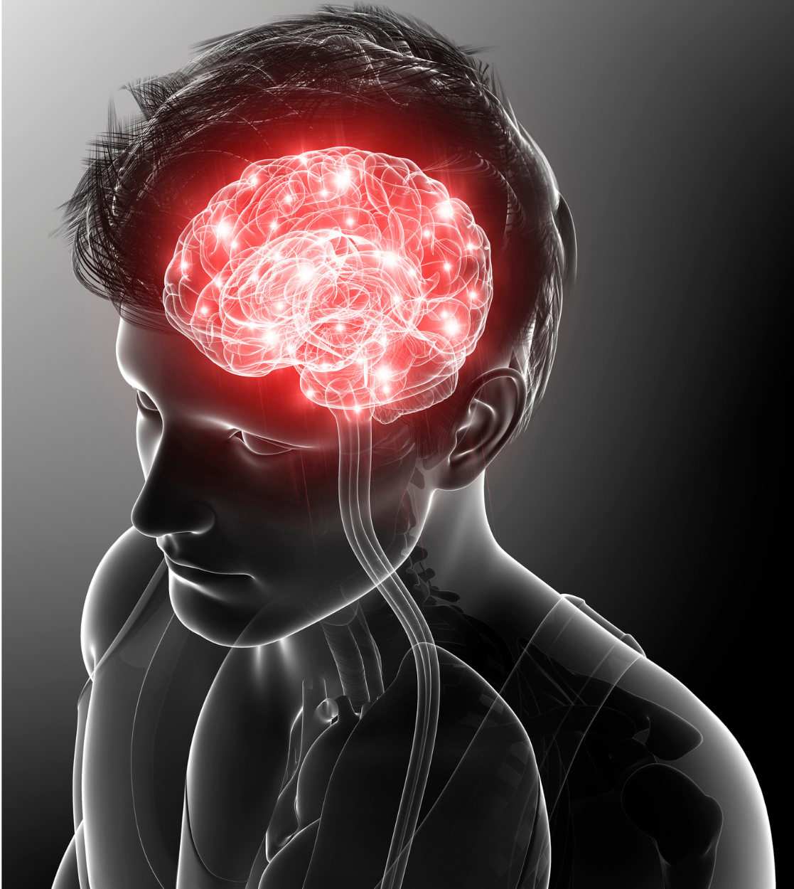 Stroke (Paralysis) - drnivedithaneurocare.com